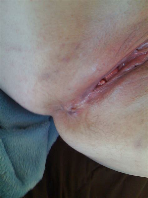 Real Women Of Xnxx Part 4 Page 102 Xnxx Adult Forum