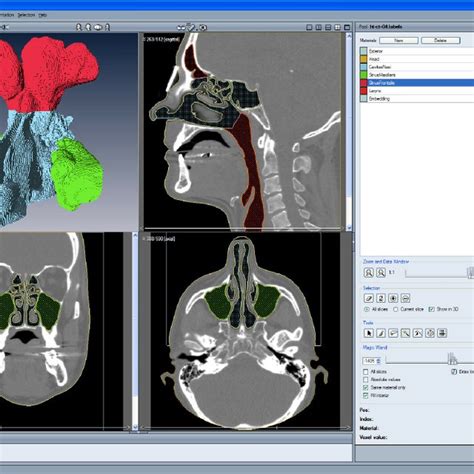 pdf 3d reconstruction of individual anatomy from medical image data segmentation and geometry