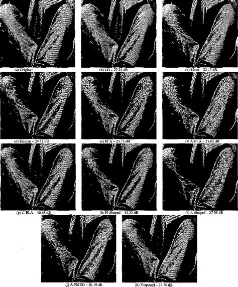 figure 2 from a median based interpolation algorithm for deinterlacing