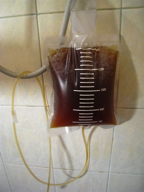 What Is A Coffee Enema The Benefits And Risks Explained