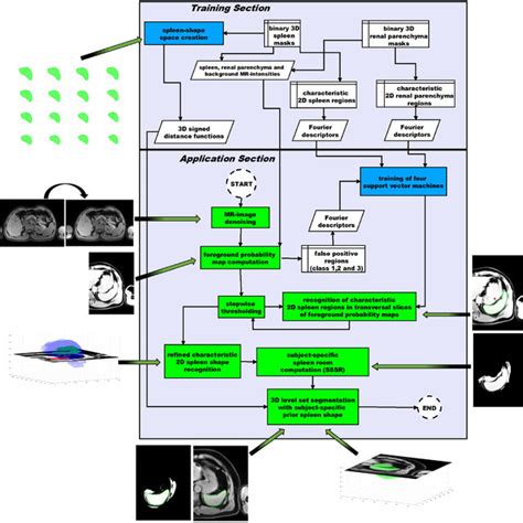 overview of spleen segmentation framework which is divided into the download scientific