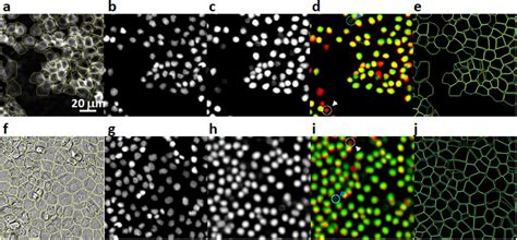 unsupervised deep learning method for cell segmentation biorxiv