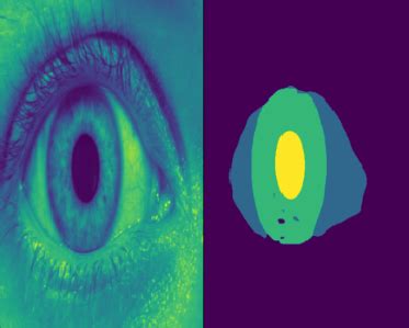 Github Aswali Eye Segmentation