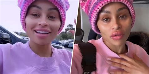 Whats It Like To Dissolve Face Fillers Blac Chyna Shares The Intense Process