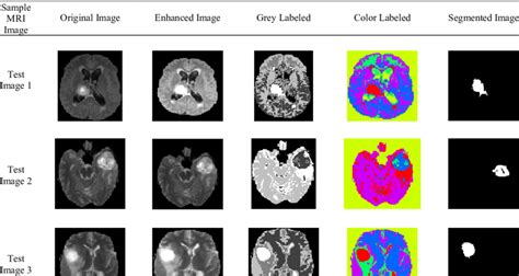 image segmentation using k means with firefly algorithm download scientific diagram