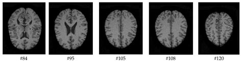 computers free full text enhancing brain segmentation in mri through integration of hidden