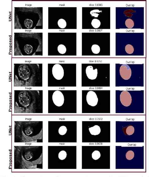 figure 6 from automatic fetus head segmentation in ultrasound images by attention based encoder