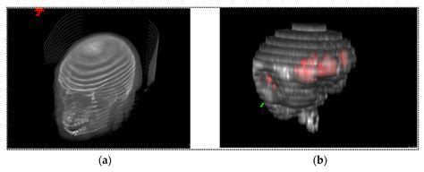 diagnostics free full text a deep learning based automatic segmentation and 3d visualization