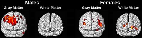 The Fundamental Difference Between Men And Women Part 1 Neurons