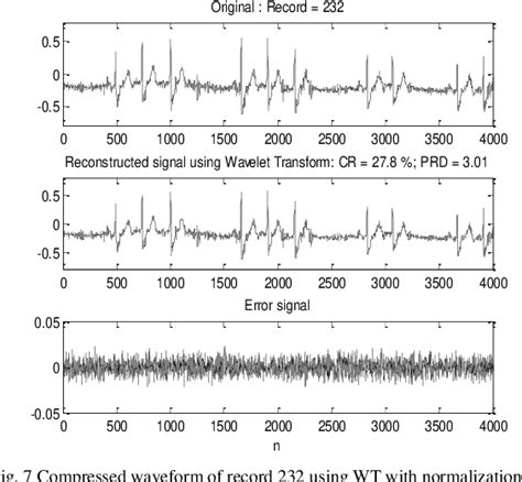 figure 1 from ecg signal compression using normalization and thresholding semantic scholar
