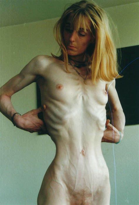 Skinny Anorexic Nude Girls Having Sex XXX Top Compilations Free Site
