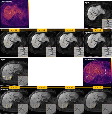 figure 4 from mr image denoising and super resolution using regularized reverse diffusion