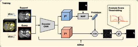 figure 1 from anomaly detection inspired few shot medical image segmentation through self