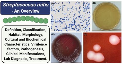 Streptococcus Mitis An Overview Microbe Notes