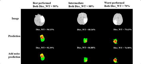 comparison of segmentation results without noise and noise added download scientific diagram
