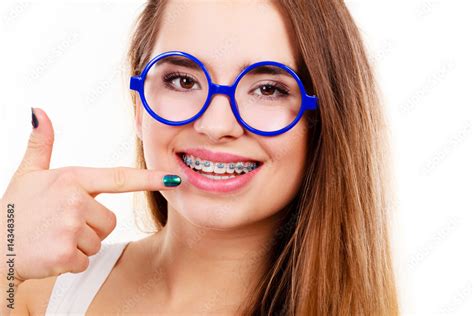 Nerdy Woman Showing Her Teeth With Braces Stock Photo Adobe Stock
