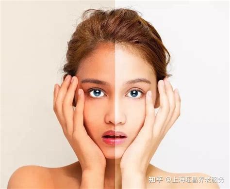 旺昌健康皮肤容易晒黑的人有一个天生的优势 知乎