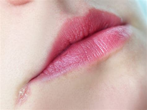 How To Heal The Corners Of Your Lips Lipstutorial Org