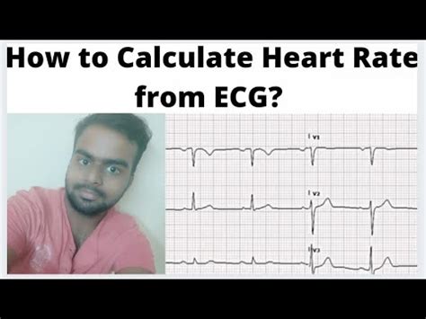 3 Methods To Calculate Heart Rate From ECG 12 Minutes 3 Methods
