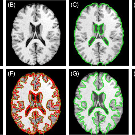 segmentation results of the mri brain tissues a b original brain download scientific diagram