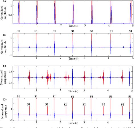 figure 4 from automatic segmentation and classification of heart sounds using modified empirical