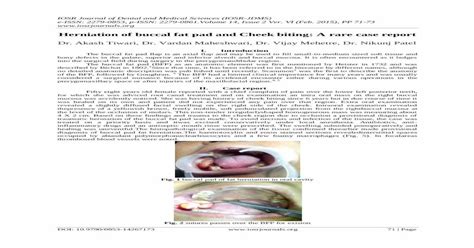 Herniation Of Buccal Fat Pad And Cheek Biting A Rare Case Iosr Jdmspapers