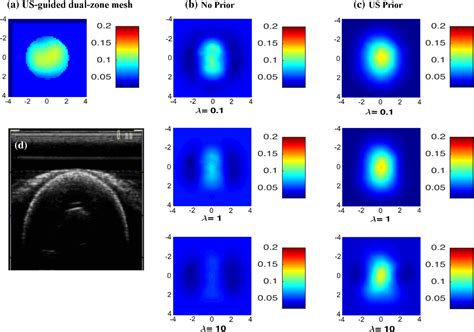 diffuse optical tomography reconstruction method using ultrasound images as prior for