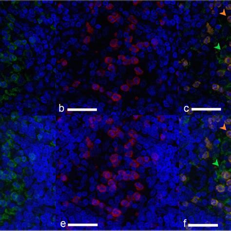Immunofluorescence Staining For IBA1 And Cytokeratin Of Macrophages