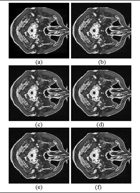 table i from mri denoising using pixel selection based non local means semantic scholar