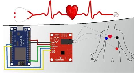 IoT ECG Monitoring With AD8232 ECG Sensor ESP8266