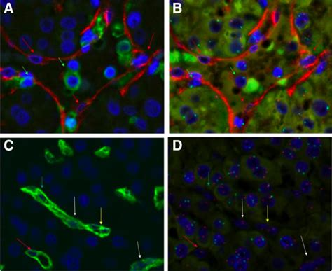 endothelial cells within hcc recurrences in patients who received download scientific diagram