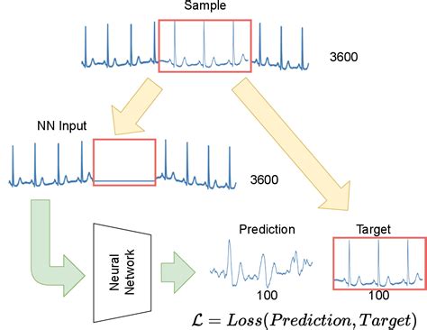figure 1 from classification and self supervised regression of arrhythmic ecg signals using
