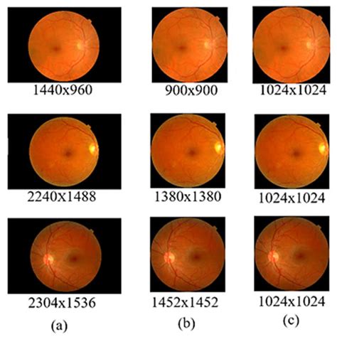 pdf analysis of medical image resizing using bicubic interpolation algorithm