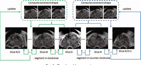 figure 1 from three dimensional prostate segmentation using level set with shape constraint