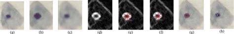 figure 4 from automated detection of cell nuclei in pap smear images using morphological