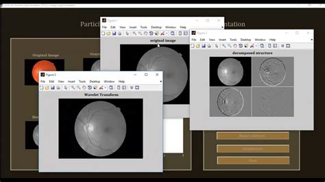 particle swarm optimization image segmentation matlab projects youtube