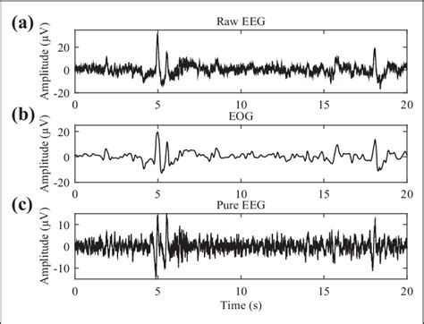 separation of eog artifact from real recorded eeg signal using download scientific diagram