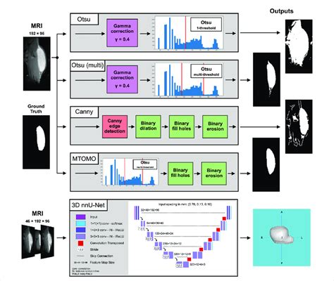 block digrams for the compared threshold based [otsu one and download scientific diagram
