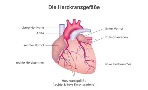 Herzinfarkt Myokardinfarkt Definition Arten Überblick
