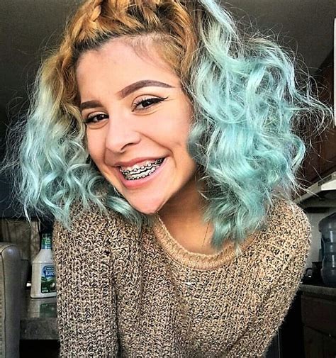 Pin Von John Beeson Auf Girls In Braces Zahnspange Zähne Ziehen Zähne