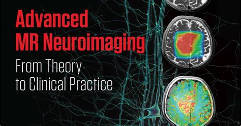 advanced mr neuroimaging from theory to clinical practice medical yukti