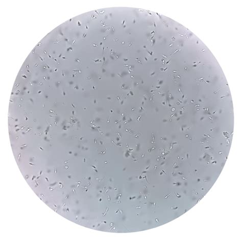 Premium Photo Photomicrograph Of Semen Analysis Show Normal Count Of