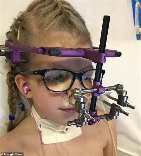 Pin By Larry Greenstein On Body Modifications And Weirdness Girls With Glasses Braces Teeth