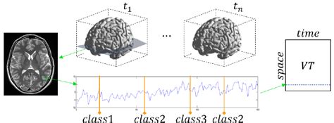 example of a typical task fmri experiment for brain decoding download scientific diagram
