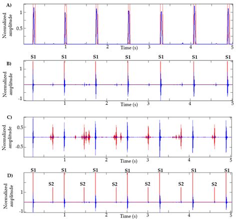 applied sciences free full text automatic segmentation and classification of heart sounds