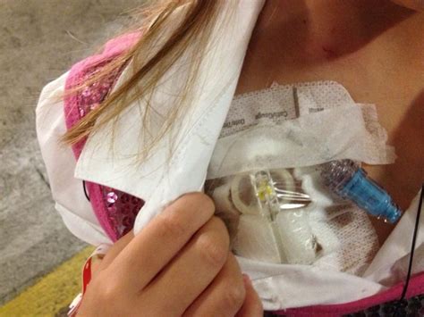 The Port Is In Unravel Pediatric CancerUnravel Pediatric Cancer
