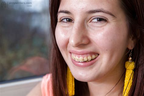 Close Ups Of Braces Adorned Amateur Andreea Showing Off Big Natural Tits Porn Pictures Xxx