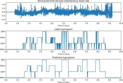 deep learning for automated sleep staging using instantaneous heart rate npj digital medicine