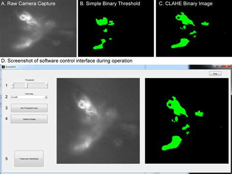 demonstration of on the fly automated thresholding for real time download scientific diagram