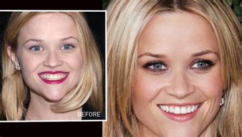 Pictures Of Reese Witherspoons Smile Hot Topic Newbeauty Celeb Makeovers And Makeunders